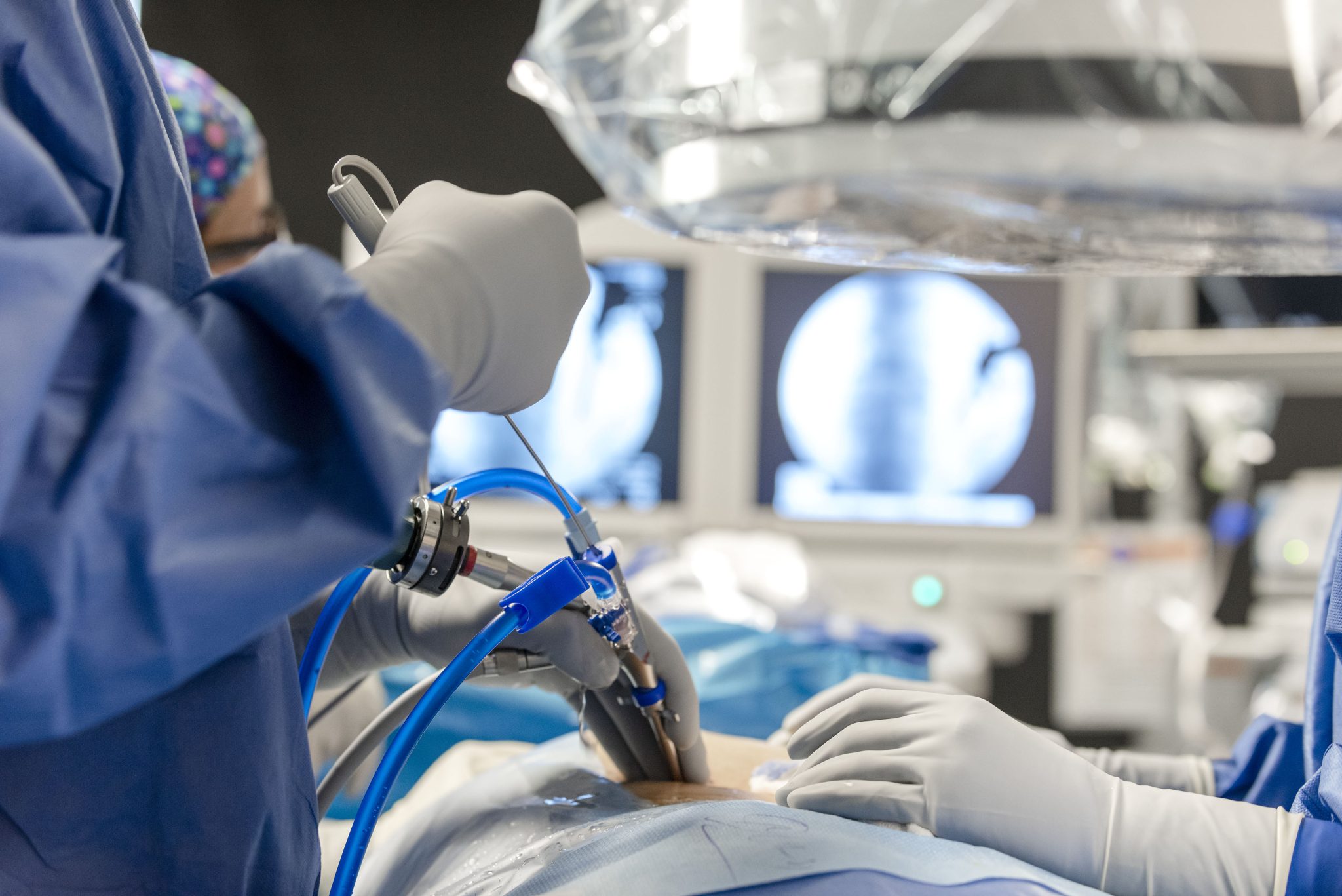 Comparing Endoscopic Spine Surgery to Traditional Open Surgery: Which ...